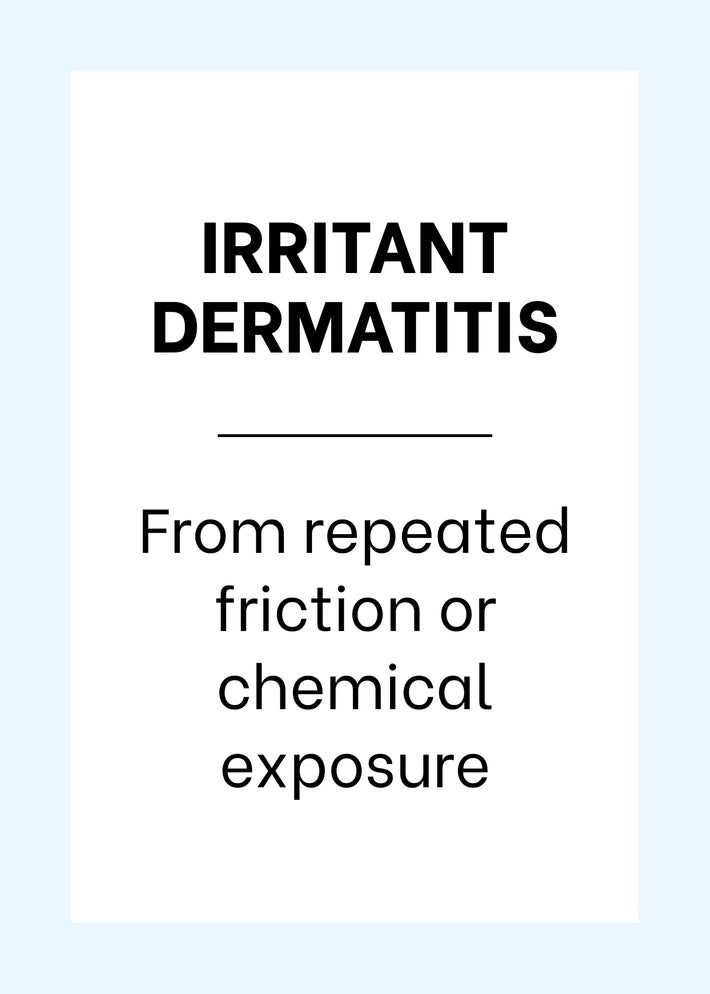 Dermatitis/Rash Treatment – Chicago Cosmetic Surgery & Dermatology