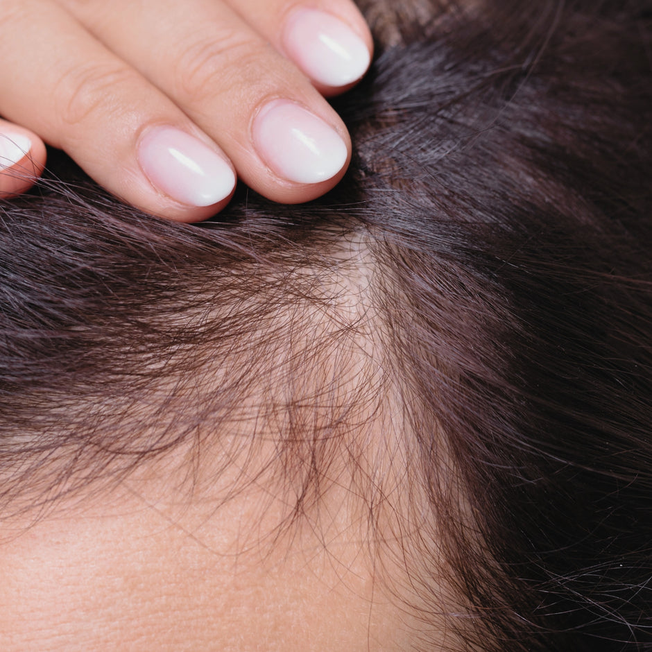 Hair & Scalp Disorders – Chicago Cosmetic Surgery & Dermatology